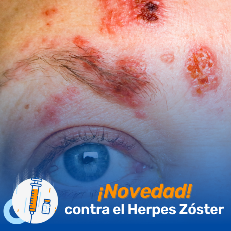 Herpes Zóster: Una nueva vacuna para esta dolorosa infección – Mega Salud